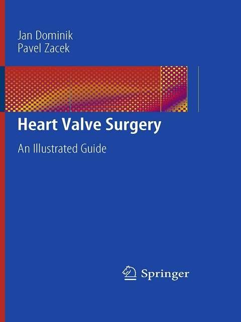 Heart Valve Surgery: An Illustrated Guide